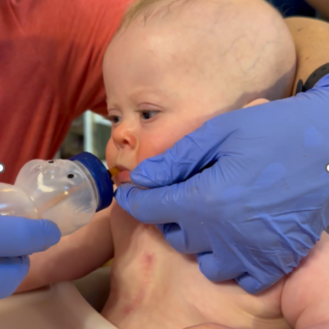 A Sensory Motor Approach to Adapted Baby Led Weaning – SpeechLab